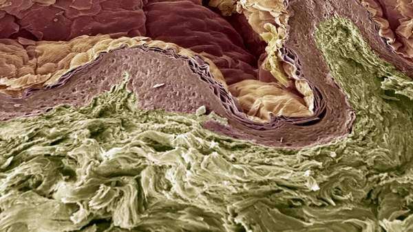 Skin tissue. Coloured scanning electron micrograph (SEM) - Stock Video ...