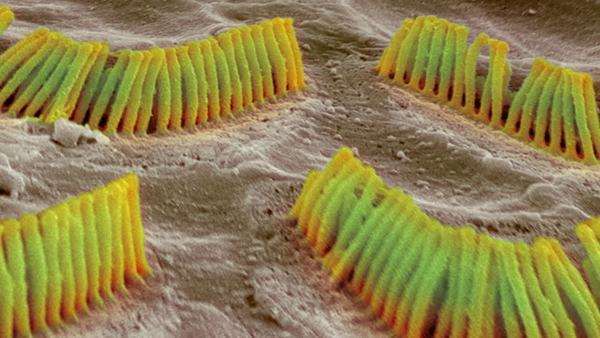Inner ear hair cells. Coloured scanning electron micrograph (SEM ...
