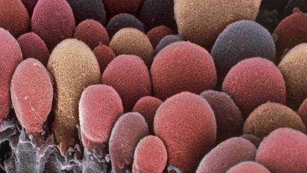Choroid plexus secretory cells. Coloured scanning electron micrograph ...