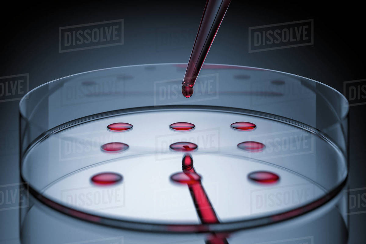 Blood sample tested on petri dish in laboratory - Royalty-free Stock ...