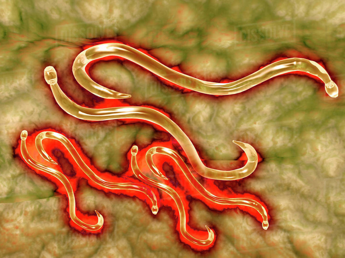 Microscopic view of hookworm. - Stock Photo - Dissolve