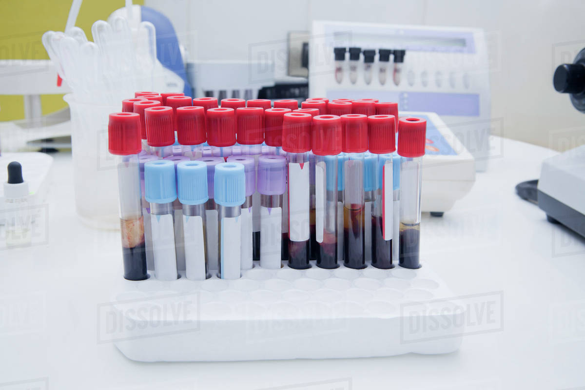 Close up of blood samples in test tube rack in laboratory - Royalty ...