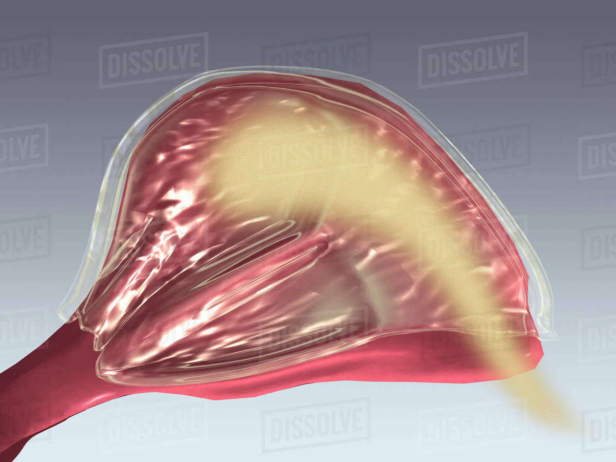 Interior view of human nasal passage mucus lining inhaling dusty air ...