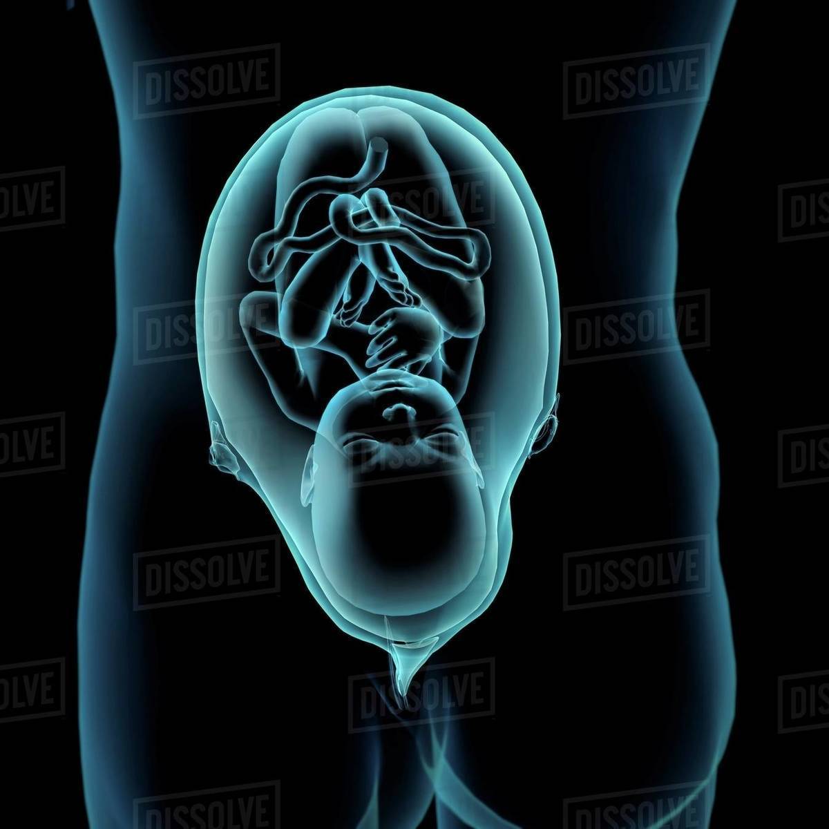 Pregnancy Anatomy, Xray frontal view of fetus in utero, Black ...