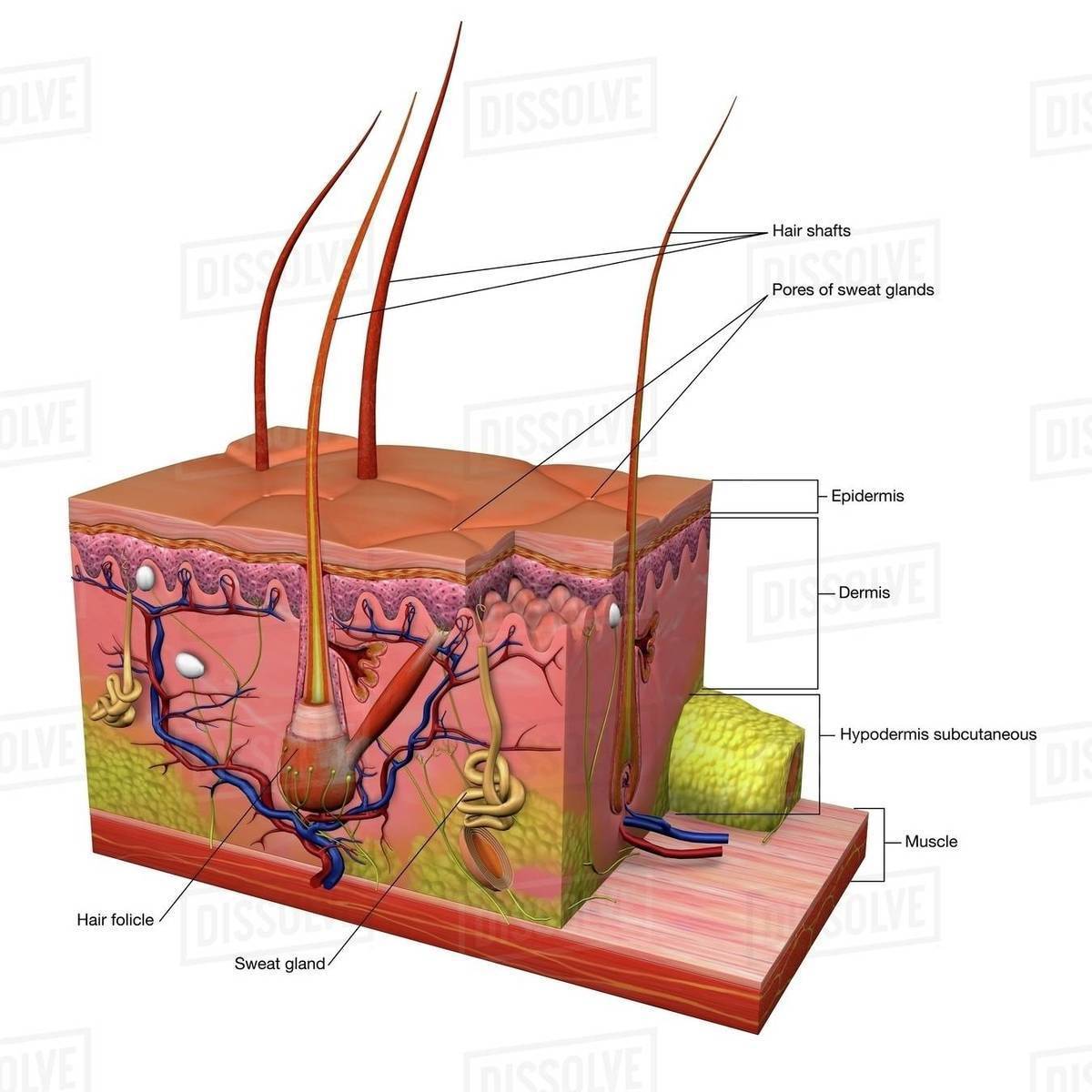 Medical illustration of human skin in cross section with text labels ...