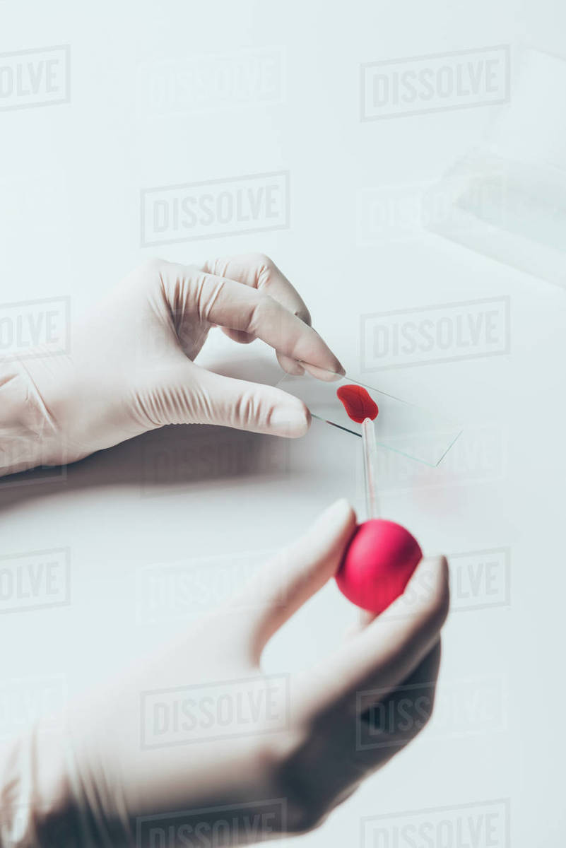 Cropped shot of doctor pouring blood from pipette onto blood slide ...