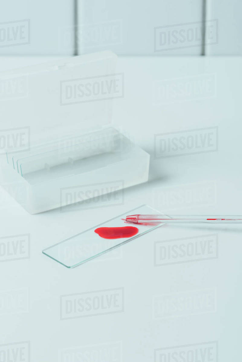 Blood sample on glass slide with pipette on white table - Royalty-free ...