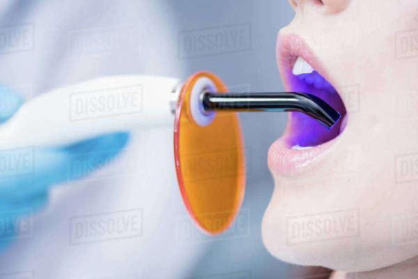 Cropped shot of patient getting teeth cured with dental curing light ...