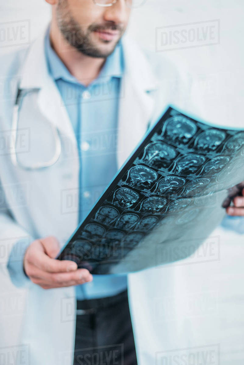 Cropped shot of doctor examining mri scan - Stock Photo - Dissolve