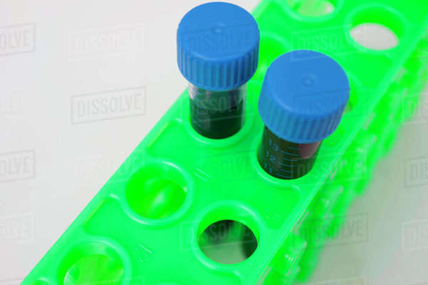 Medical samples in test tubes in research laboratory - Stock Photo ...