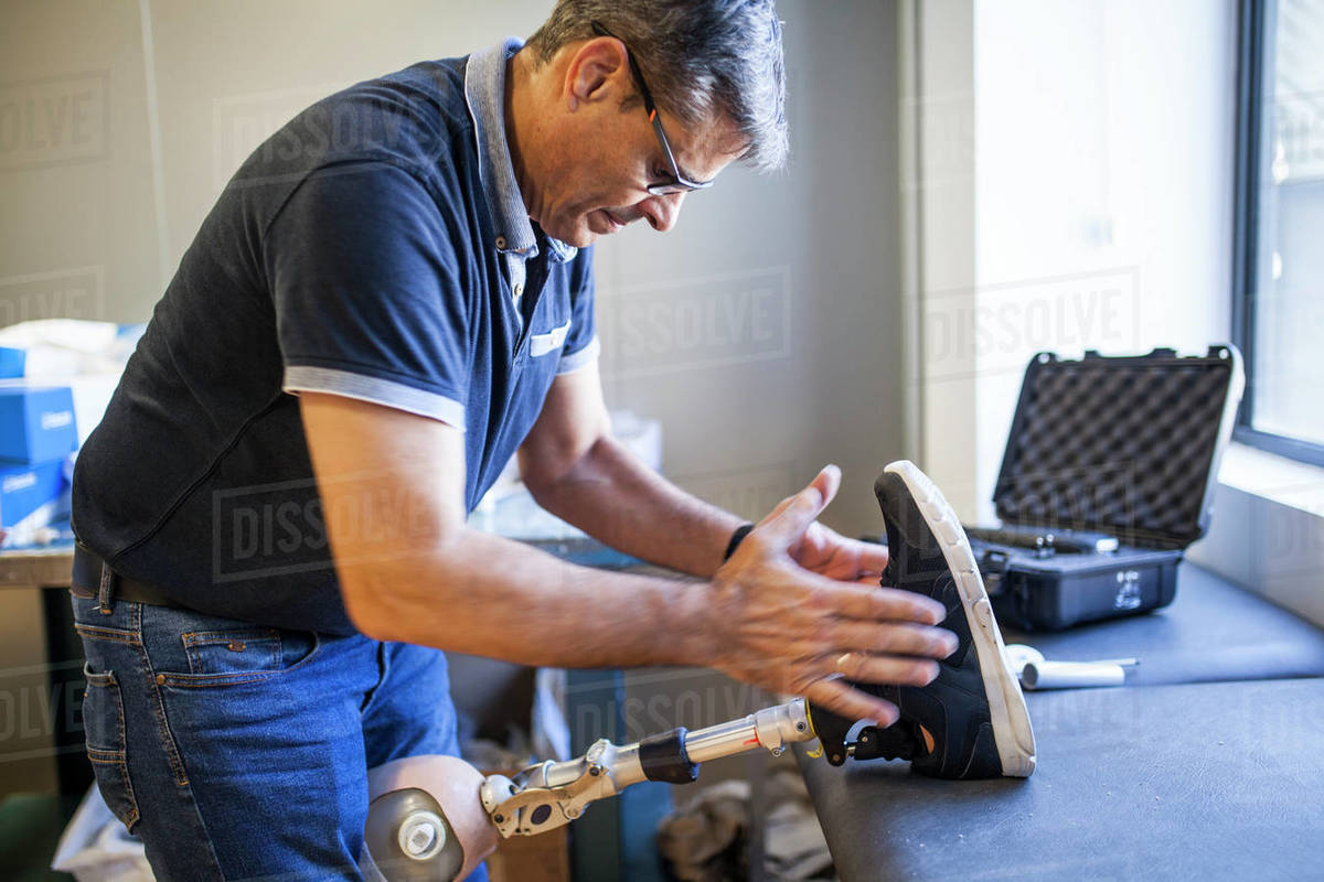 Prosthetic engineer reviewing the prosthesis of a patient and improving ...