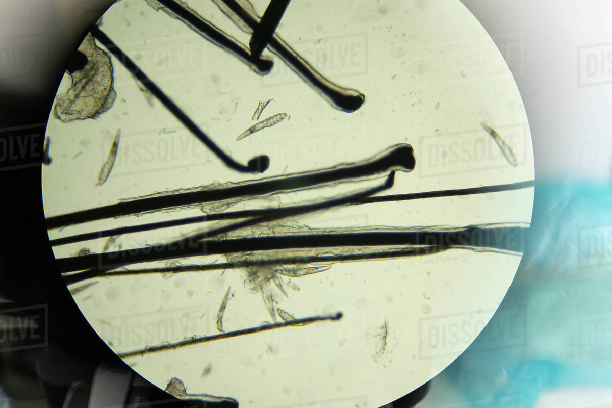 Top view of hair with small parasites placed under lens of modern ...