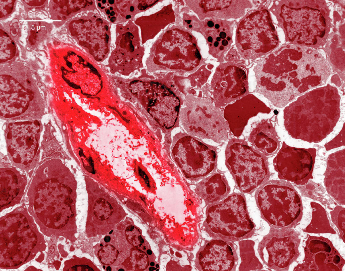 Transmission electron micrograph of bone marrow - Royalty-free Stock ...