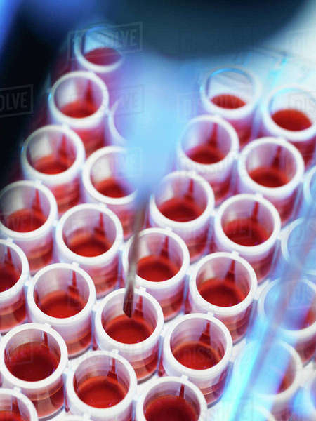Automated blood screening - Stock Photo - Dissolve
