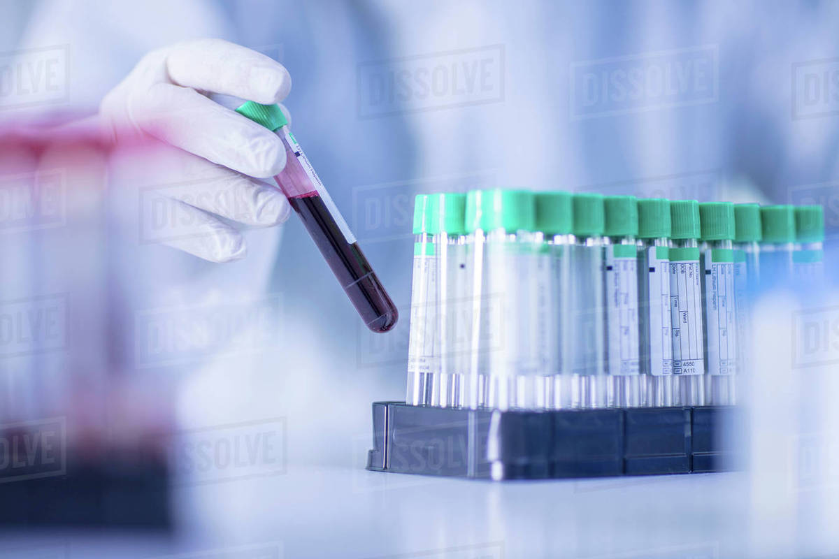 Laboratory worker placing liquid filled test tube in rack. close-up ...