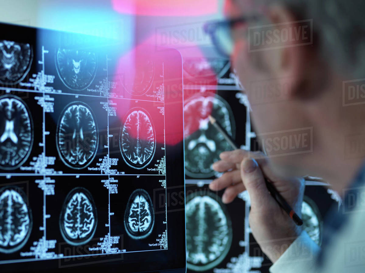 Doctor viewing brain scans for possible disease or damage in clinic ...