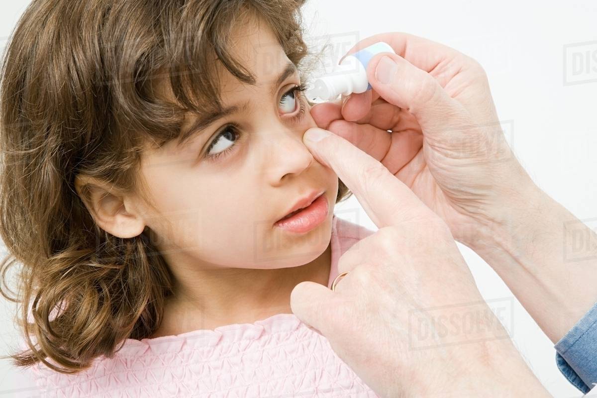 Girl having eye drops put in - Royalty-free Stock Photo | Dissolve
