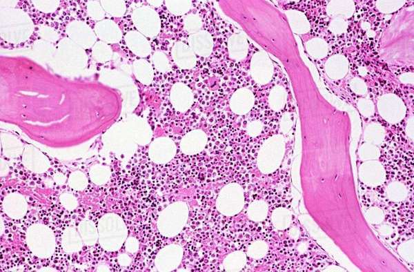 Bone marrow - Stock Photo - Dissolve