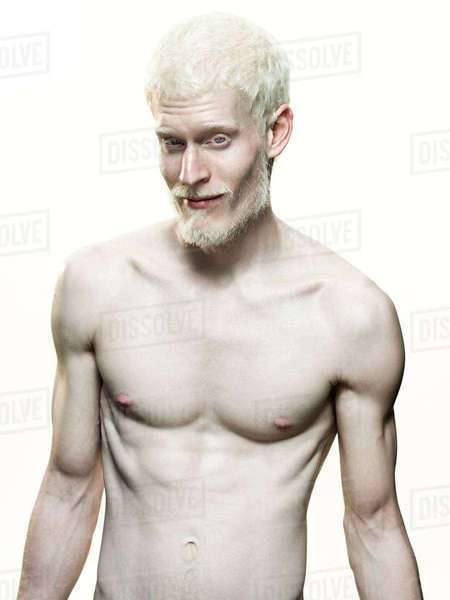 Pale man - Stock Photo - Dissolve