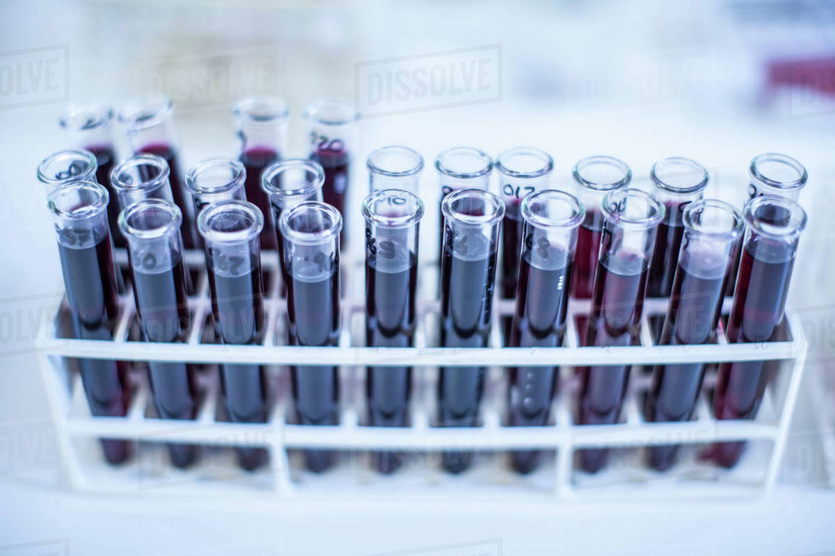 Rack of test tubes filled with liquid, close-up - Royalty-free Stock ...