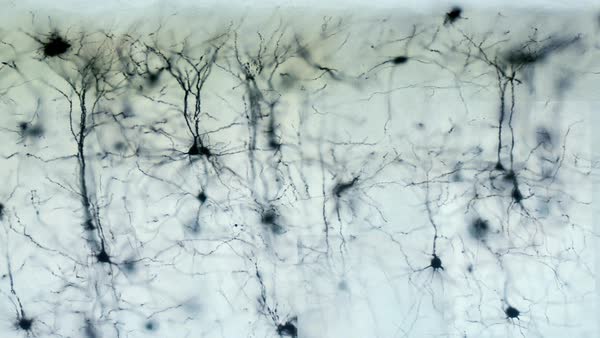 Neuronal cells from rat brains - 4K Rights-managed Stock Video Footage ...