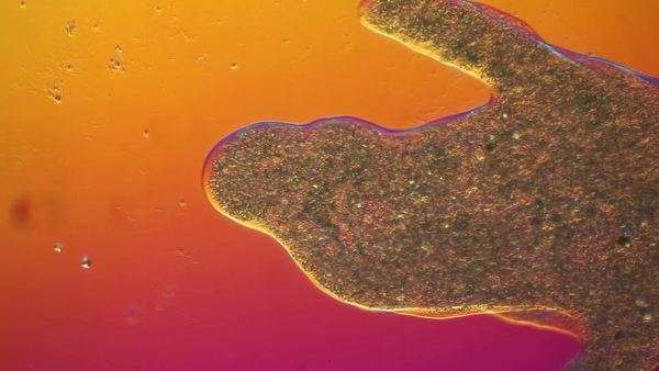 Light microscopy of the pseudopod of a Chaos carolinensis amoeba ...