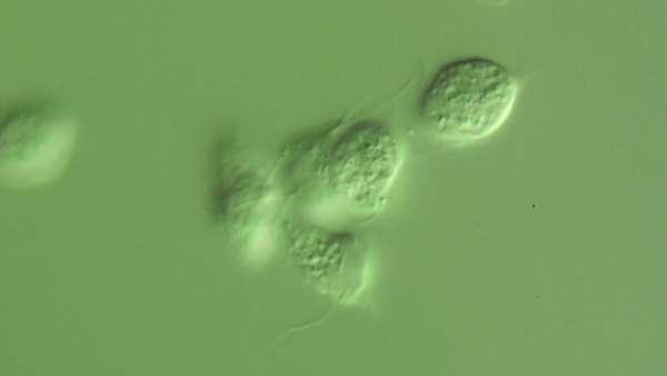 Trichomonas vaginalis parasites, high-speed light microscopy - HD ...