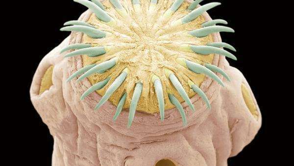 Animated scanning electron micrograph (SEM) of the head of a pork ...