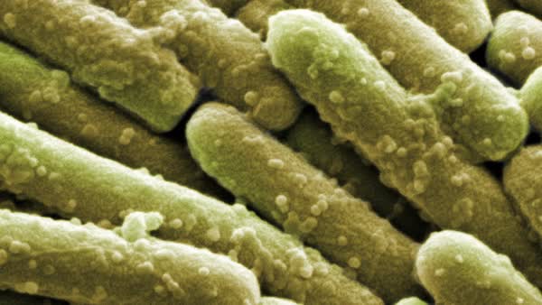 Streptococcus thermophilus bacteria, coloured scanning electron ...