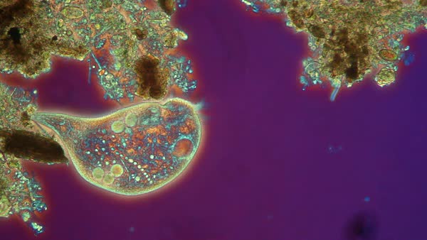 Stentor polymorphus. Light microscope footage of several trumpet-like ...