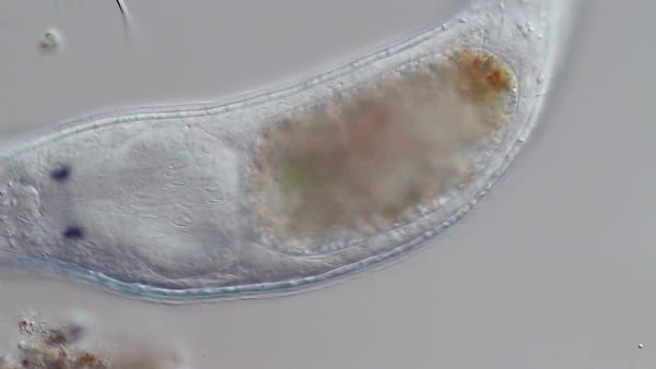 Ciliates on algae. Light microscope footage of ciliate protozoa moving ...