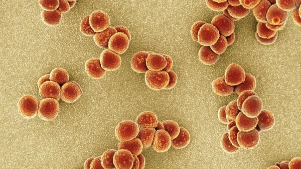 MRSA bacteria, Animated coloured scanning electron micrograph (SEM ...