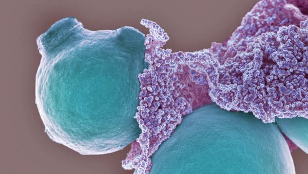 Animated coloured scanning electron micrograph (SEM) of Candida ...