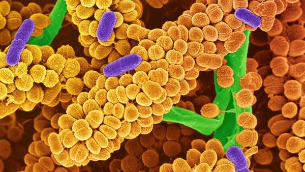 Streptococcus bacteria. Animated coloured scanning electron micrograph ...