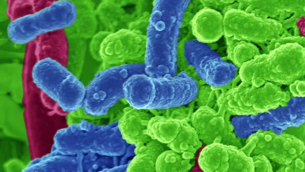 Oral bacteria. Animated coloured scanning electron micrograph (SEM) of ...