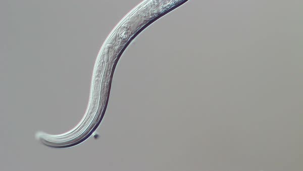 Nematode. Light microscope of a freshwater nematode. - Stock Video ...