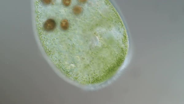 Stentor protozoa feeding on green algae. Light microscopy of the ...