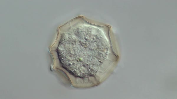 Shelled amoeba. Light microscope of an Arcella sp. testate (shelled ...