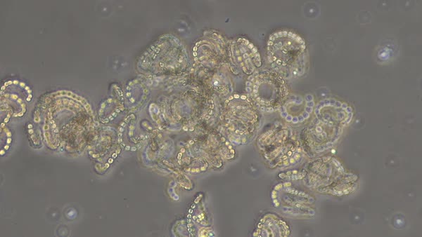 Light microscope footage of Synura sp. algae colonies. Synura (from the ...
