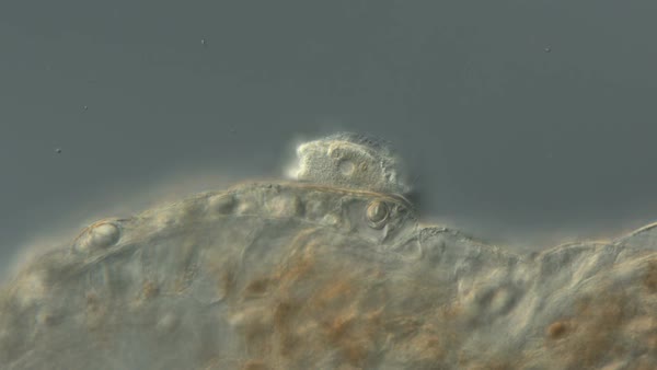 Light microscope footage of Trichodina pediculus, a peritrich ciliate ...