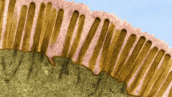 Microvilli in human intestine, animated coloured transmission electron ...