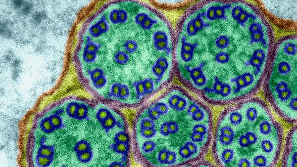 Sectioned cilia, animated coloured transmission electron micrograph ...