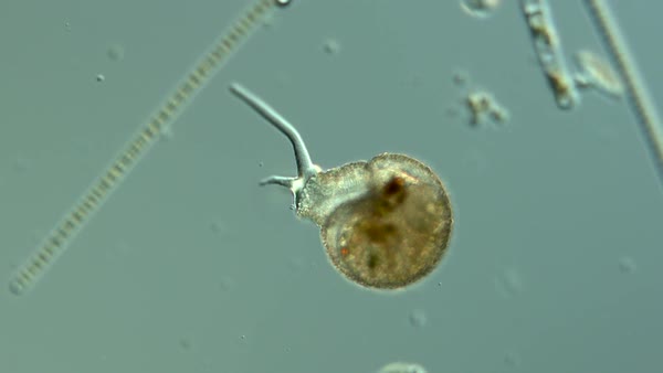 Shelled amoeba. Light microscope of an Arcella sp. testate (shelled ...