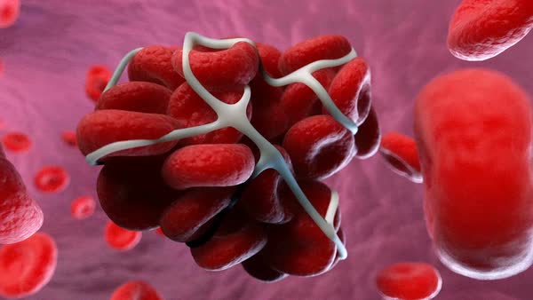 Blood clot in the blood stream, animation - HD Royalty-free Stock Video ...