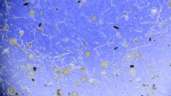 Microscopic footage of marine zooplankton in water. This sample was ...