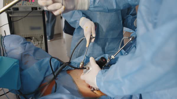 Surgeons team during process operation uterus removal with surgical ...