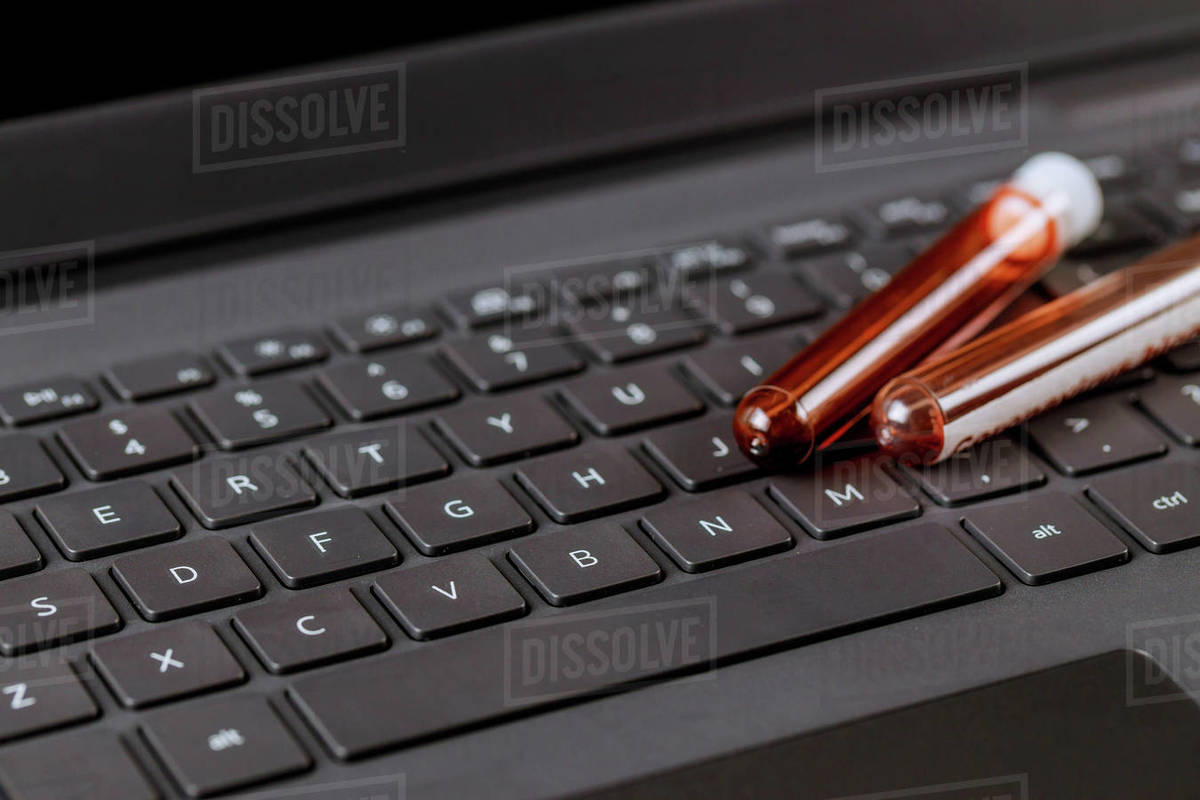 Medical equipment blood tubes on stand with working on laptop computer ...