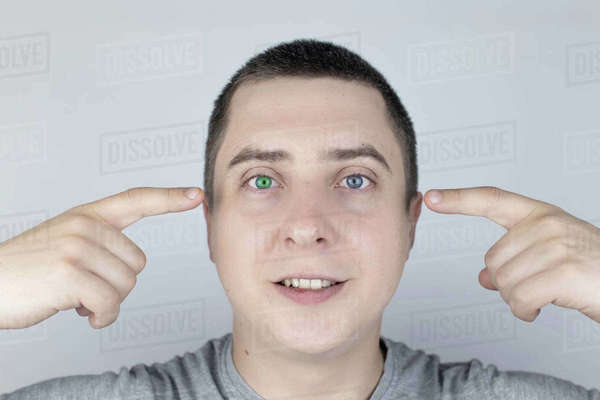 A man with different color eyes looks into the frame. The right eye is ...