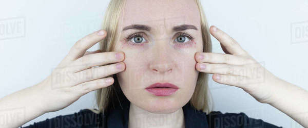 Allergy to cosmetics. The girl looks at the pimples around her eyes ...