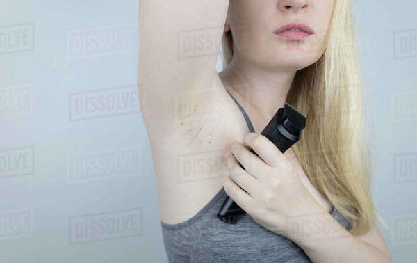 Armpit rash. Underarm skin irritation. Blonde girl shows irritation on ...